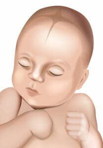 Vauvan aukileet eli pään pehmeät alueet ovat olemassa hyvästä syystä ...